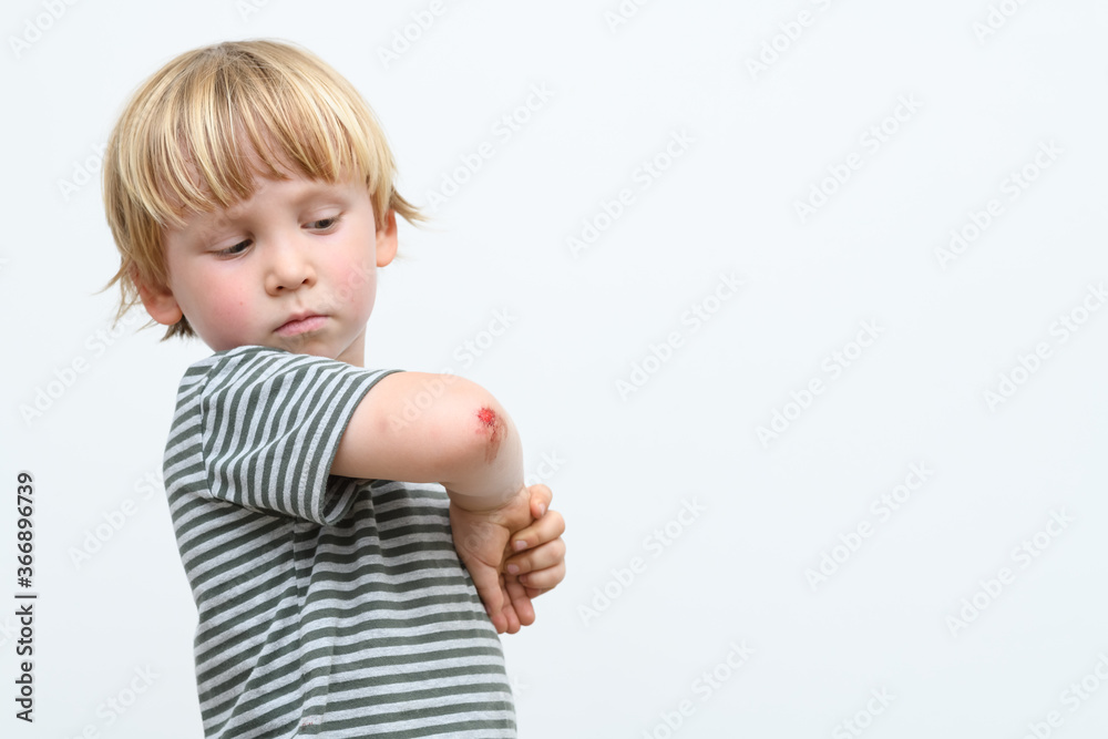 boy kid arm accident wound he painful abrasion scratches from fall ...