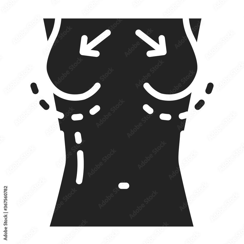 Female breast augmentation black glyph icon. Plastic body surgery ...