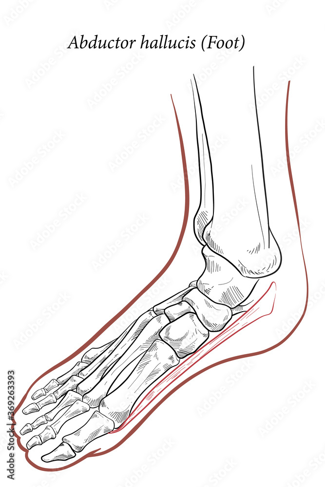 Medical illustration of Abductor hallucis muscle foot. Stock Vector ...
