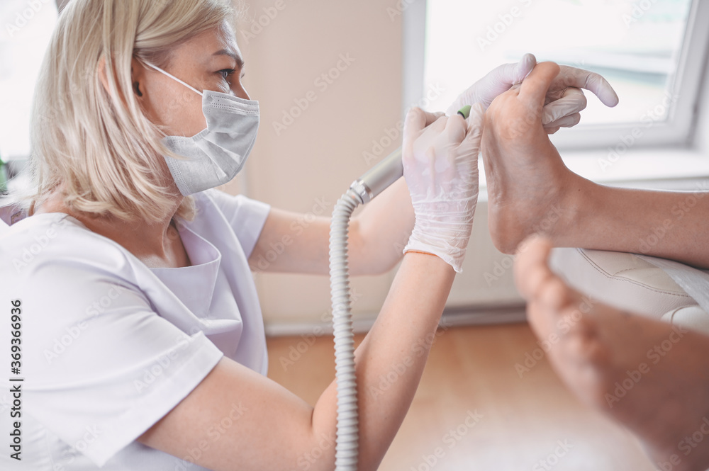 Podiatrist using grinding equipment and making procedure polish for ...