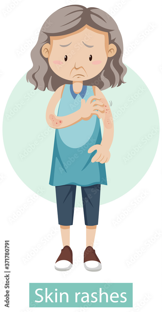 Cartoon character with skin rashes symptoms Stock Vector | Adobe Stock