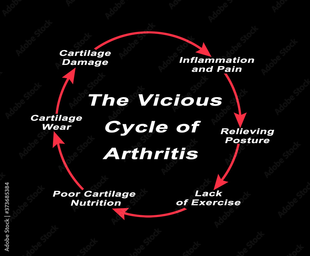 Steps in Vicious Cycle of Arthritis Stock Illustration | Adobe Stock