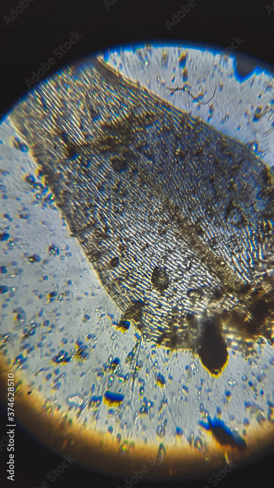 Mycetozoa slime mold and Purple sulfur bacteria PSB in dead shell of ...