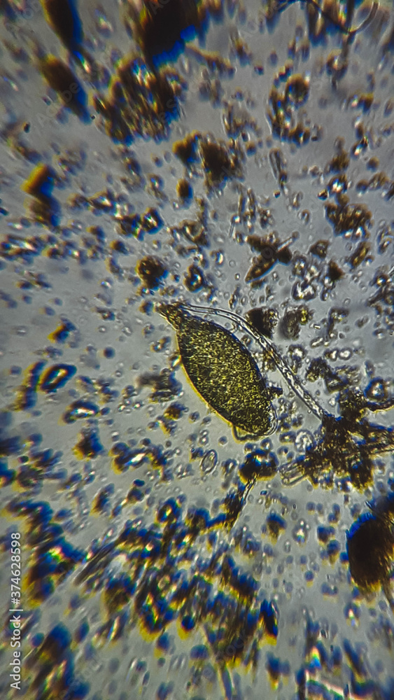 Stock-Foto „Mycetozoa slime mold and Purple sulfur bacteria PSB in dead ...