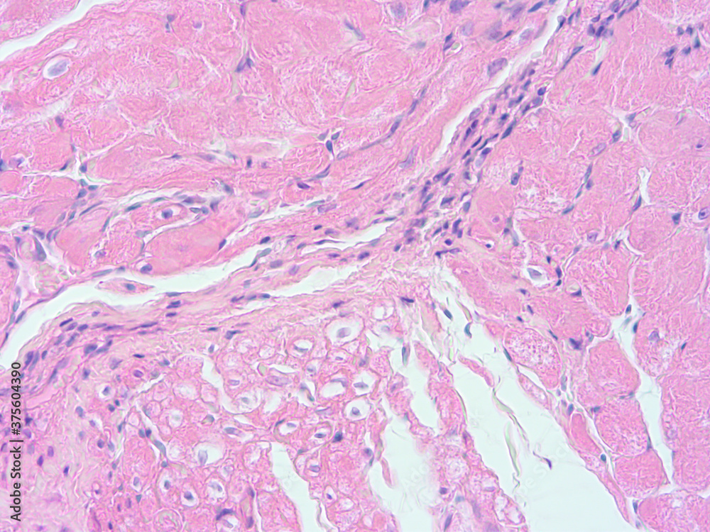 picture of histology human tissue with microscope from laboratory (not ...