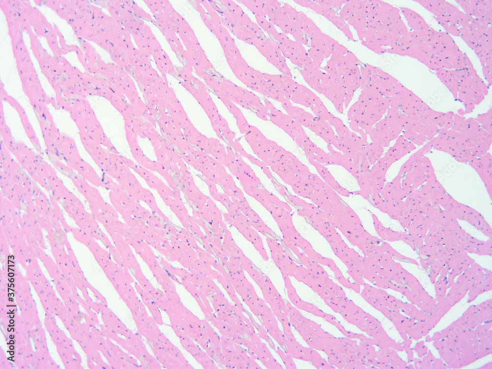 picture of histology human tissue with microscope from laboratory (not ...