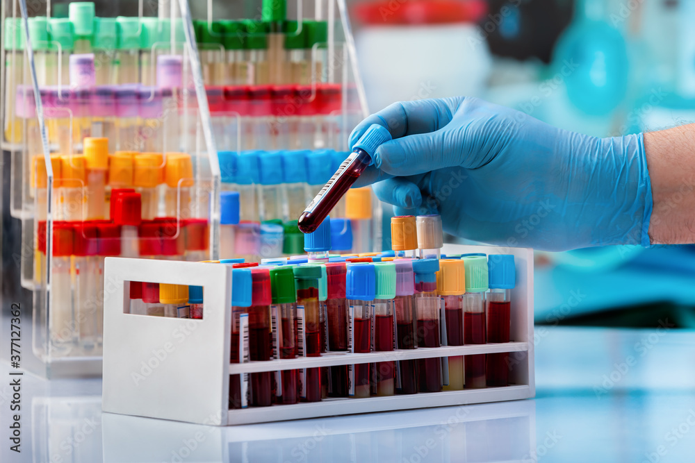 Photo Stock Doctor holding blood tube in the blood bank laboratory of ...