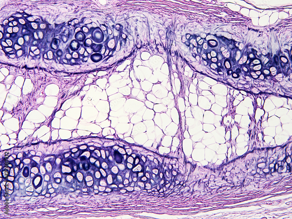 Histology of human tissue, show epithelial tissue and connective tissue ...