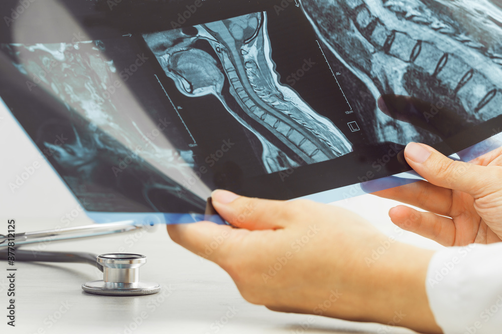 Female doctors hand pointing at x-ray or MRI medical imaging with a ...