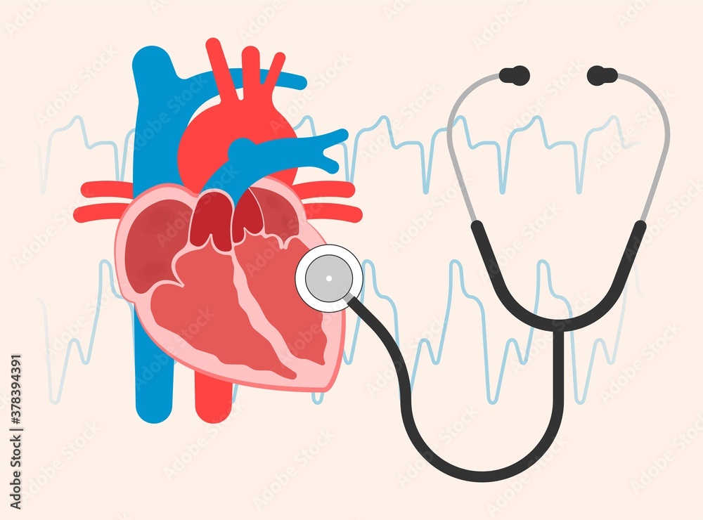 Cath Lab Atrial Septal Defect Tetralogy of Fallot Patent Foramen Ovale ...