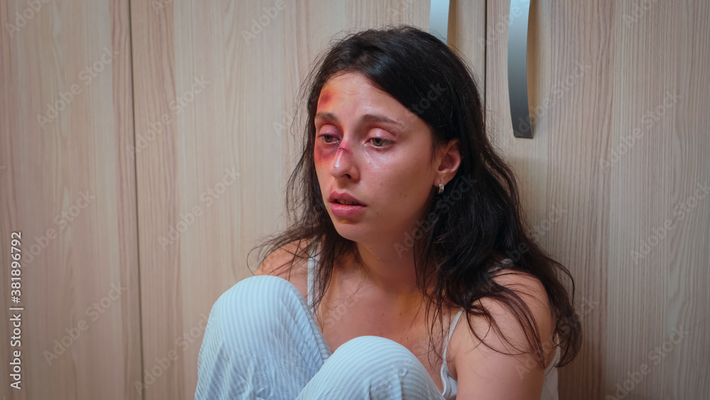 Beaten woman, victim of domestic violence sitting on the floor ...