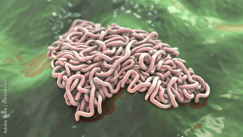 Parasitic worms in intestine Stock Illustration | Adobe Stock