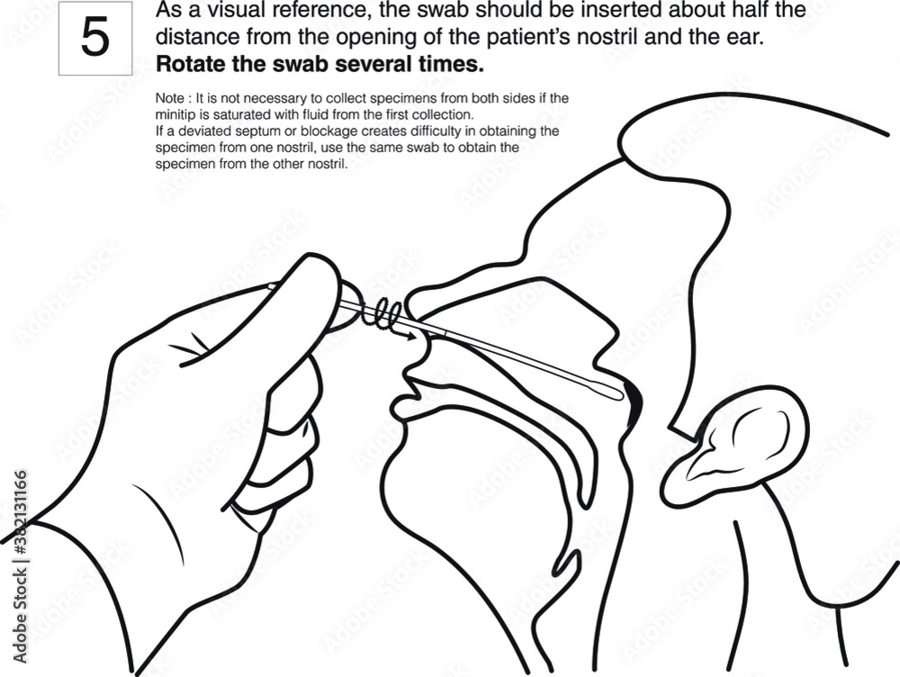 Step 5 : As a visual reference, the swab should be inserted about half ...
