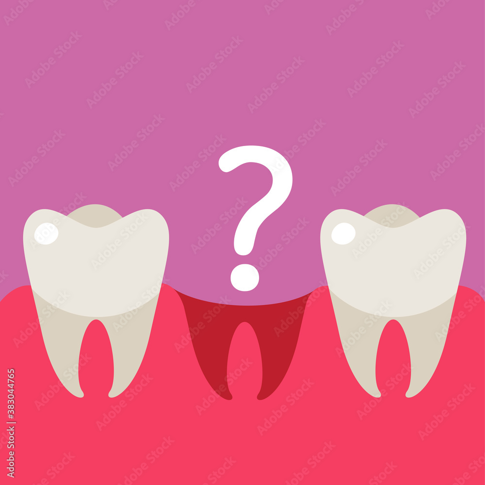 Tooth extraction, denture flat cartoon illustration. Wisdom tooth ...