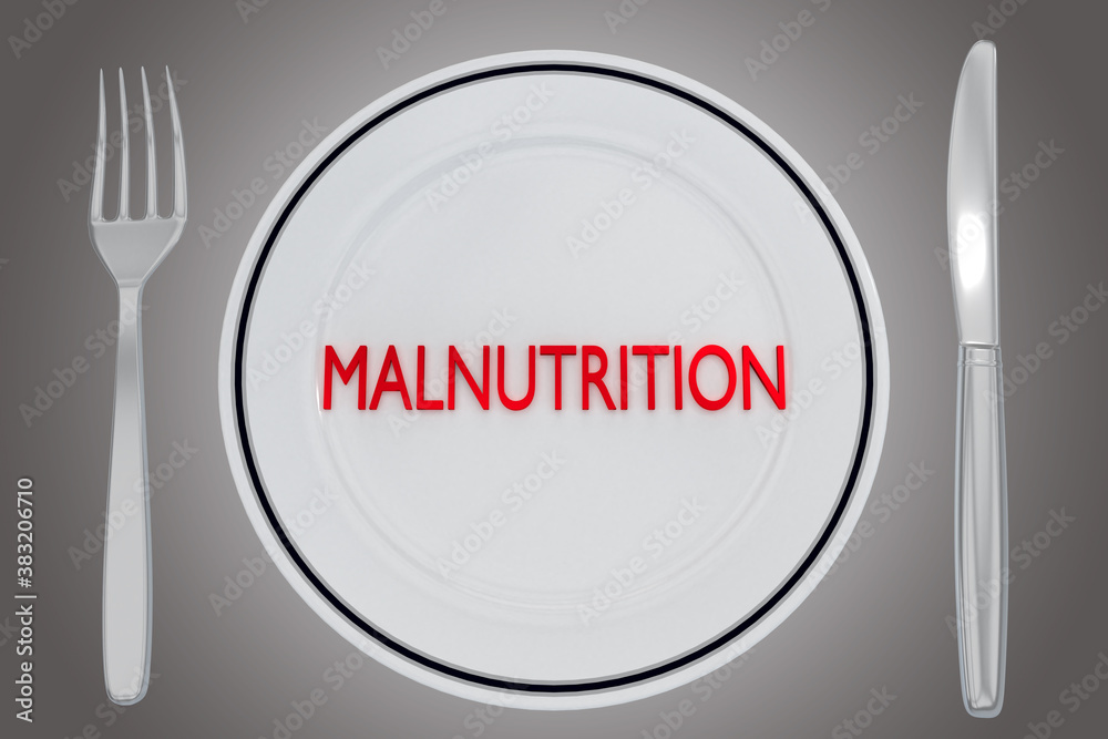 MALNUTRITION - health concept Stock Illustration | Adobe Stock