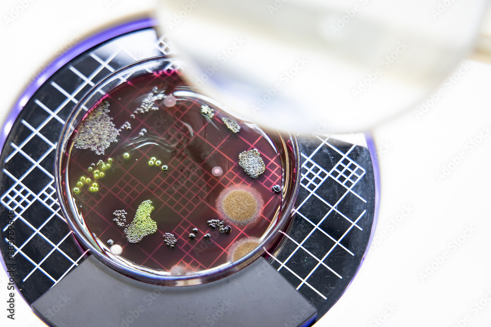 Bacteria Escherichia coli (E. coli) culture in petri dish with ...