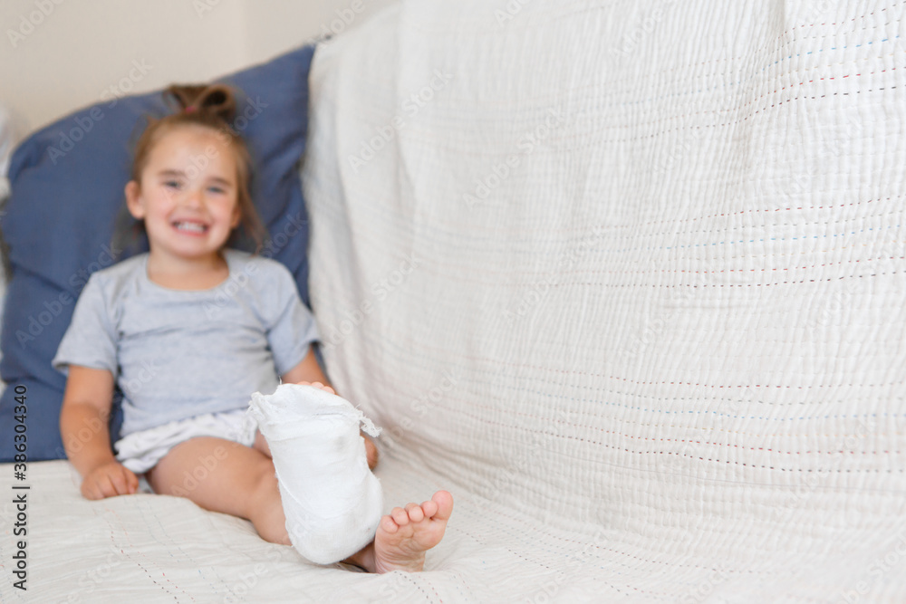 broken leg. Close-up of the cast on the feet. exercises to repair and ...