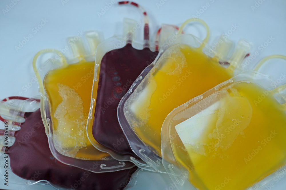 ภาพถ่าย Stock packed red cell (PRC) and fresh frozen plasma (FFP) bags ...