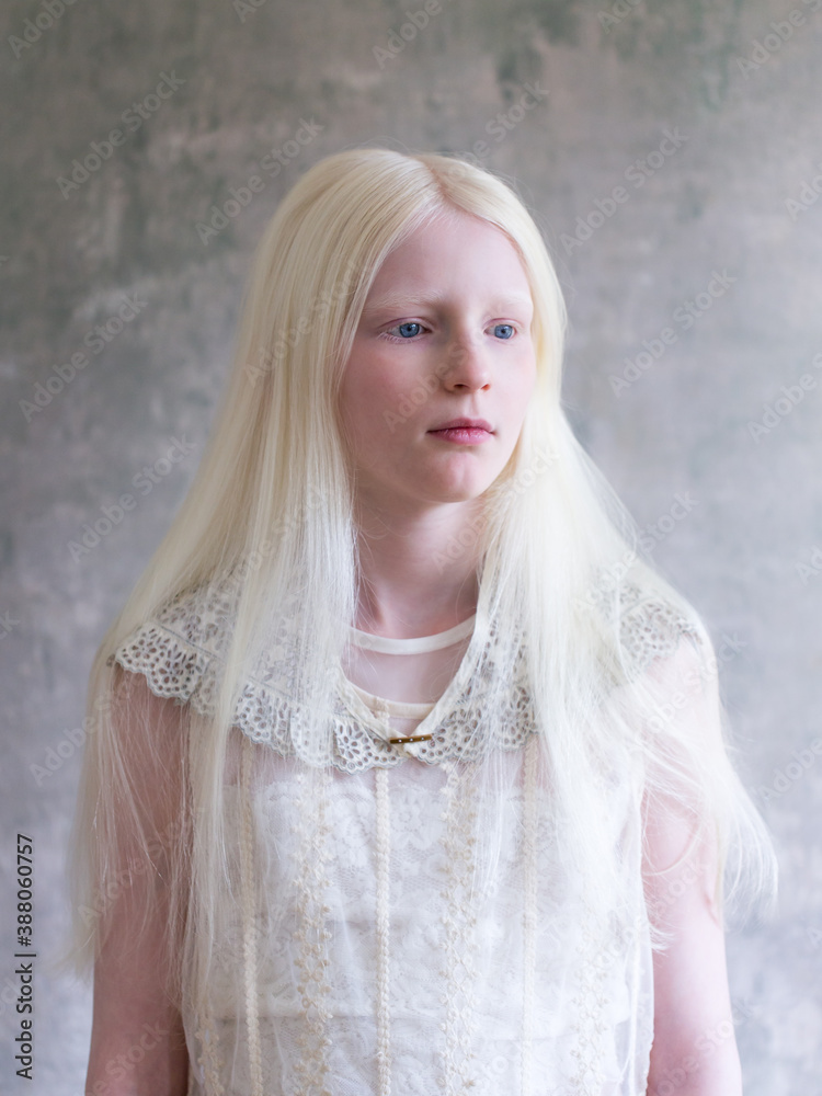 Medium vertical natural light portrait of beautiful blue-eyed albino ...