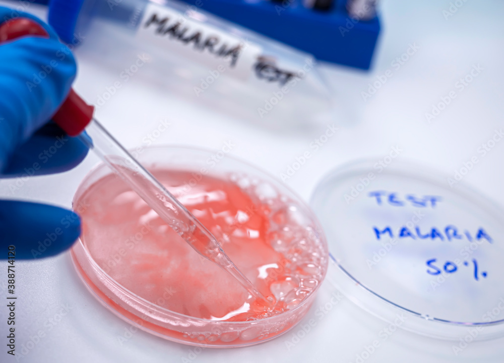 Laboratory research on the insecticide clothianidin, cause of malaria ...