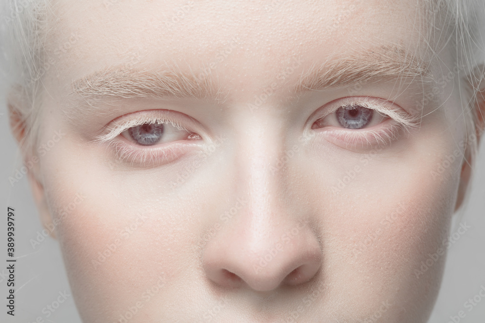 Nose and eyelid. Close up portrait of beautiful albino female model ...