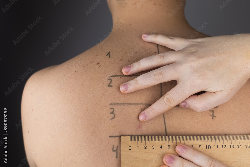 An allergist or dermatologist examines red spots on a man’s face. The ...
