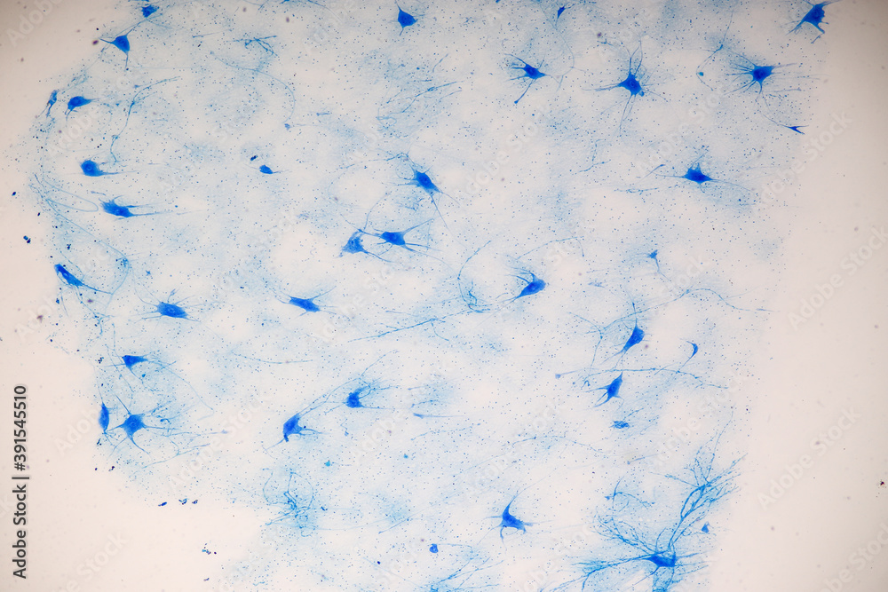 Education Spinal cord and Motor Neuron under the microscope in Lab ...