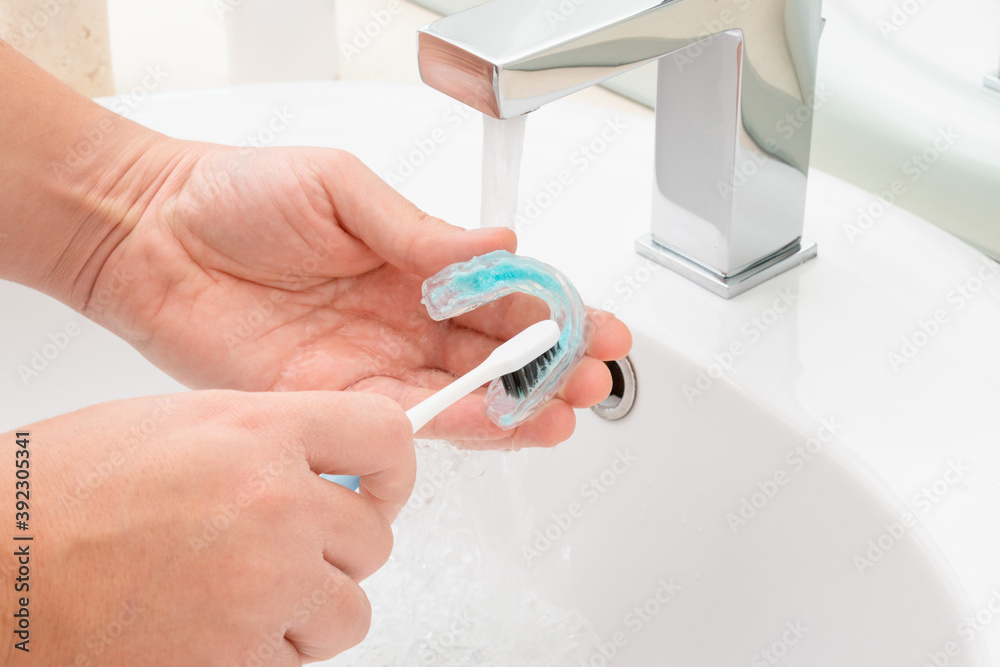 Washing and removing organic residues in orthodontic appliance ...