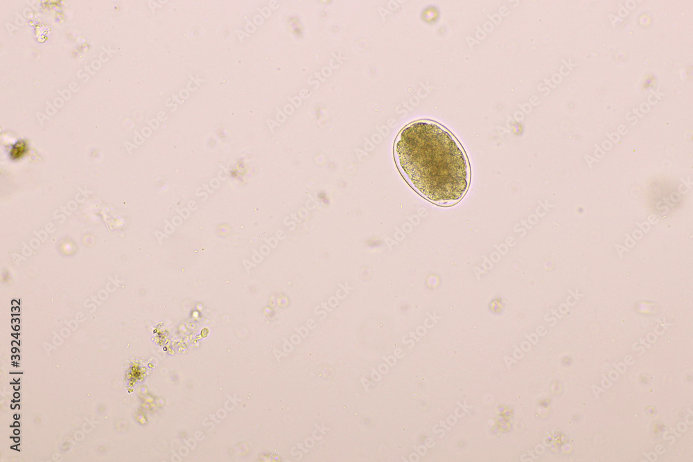 Egg of Hookworm in human stool, analyze by microscope, original ...