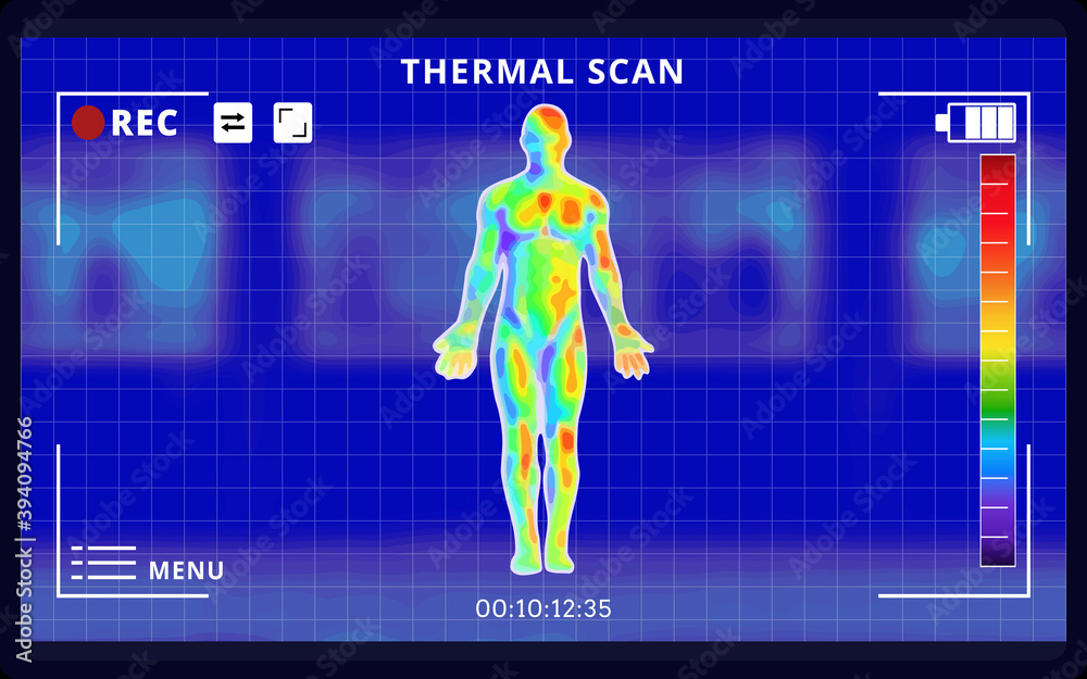 Vector graphic of Medical thermal imaging of Human front body scan by ...