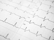Ecg Free Stock Photo - Public Domain Pictures