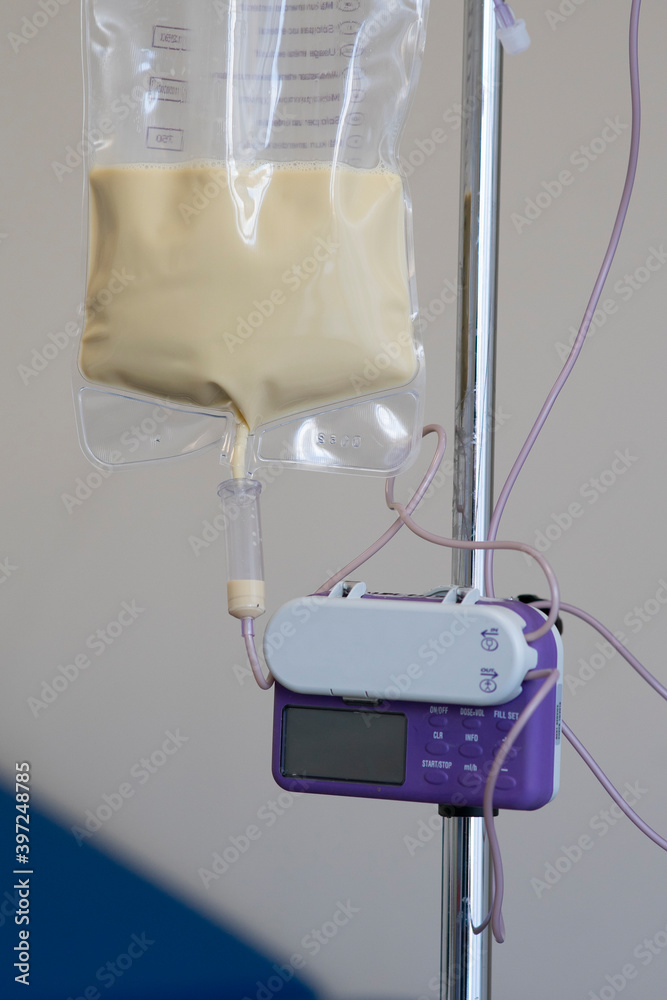 Feeding Pump medical device purple color to supplement nutrition liquid ...