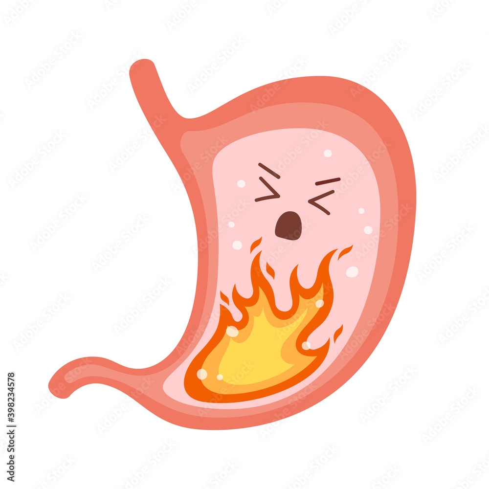 Human stomach on fire. Heartburn, gastritis and acid reflux ...