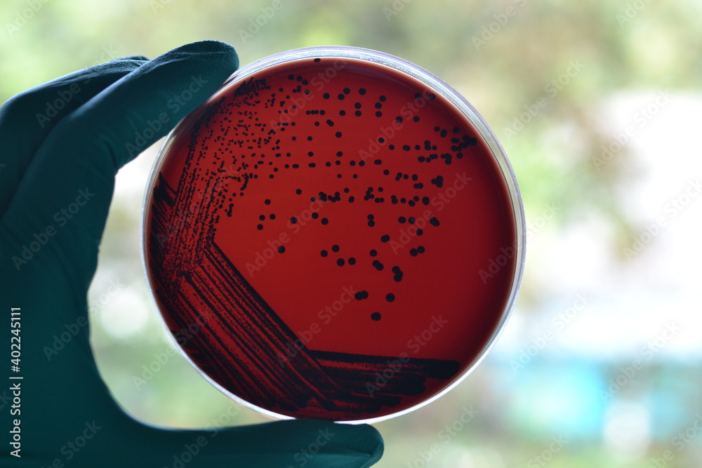 Photo Stock Corynebacterium, Corynebacterium on tellurite blood, agar ...