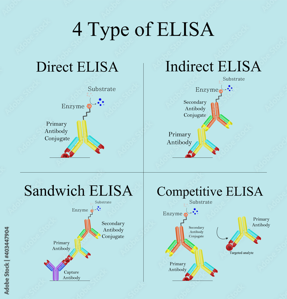 4 type of ELISA in laboratory, Direct, Indirect, Sandwich and ...