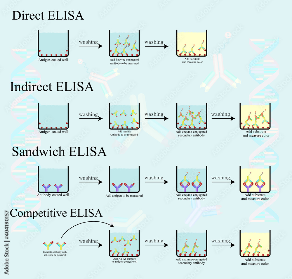 4 Type of ELISA infographic concept show protocol testing in laboratory ...