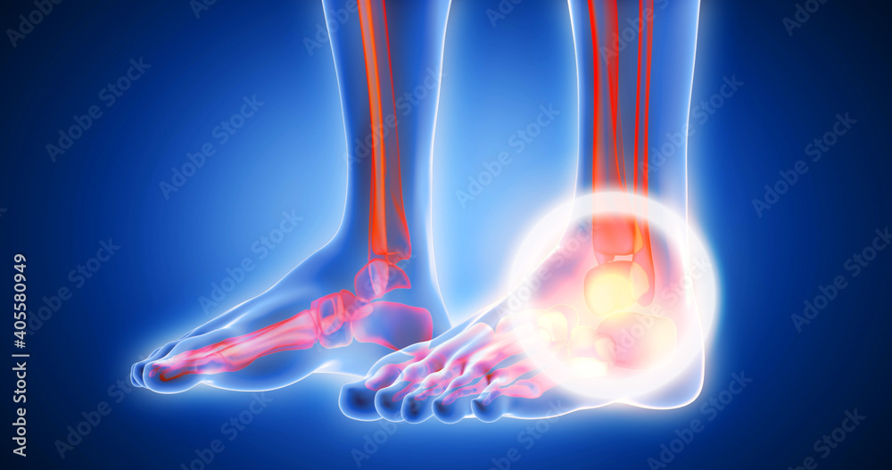 Illustration Stock Leg pain, foot pain, human skeleton, bone scan, joint, medical screen 3D ...
