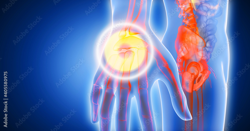 Pain in the arm, pain in the fingers, human skeleton, bone scan, joint ...