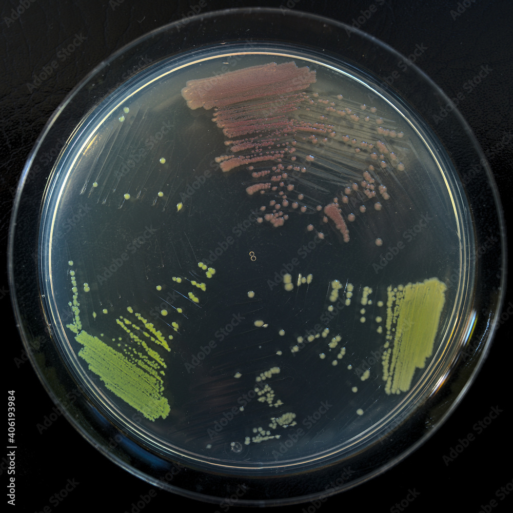 Fotografie Petri dish of bacteria expressing fluorescent proteins under ...