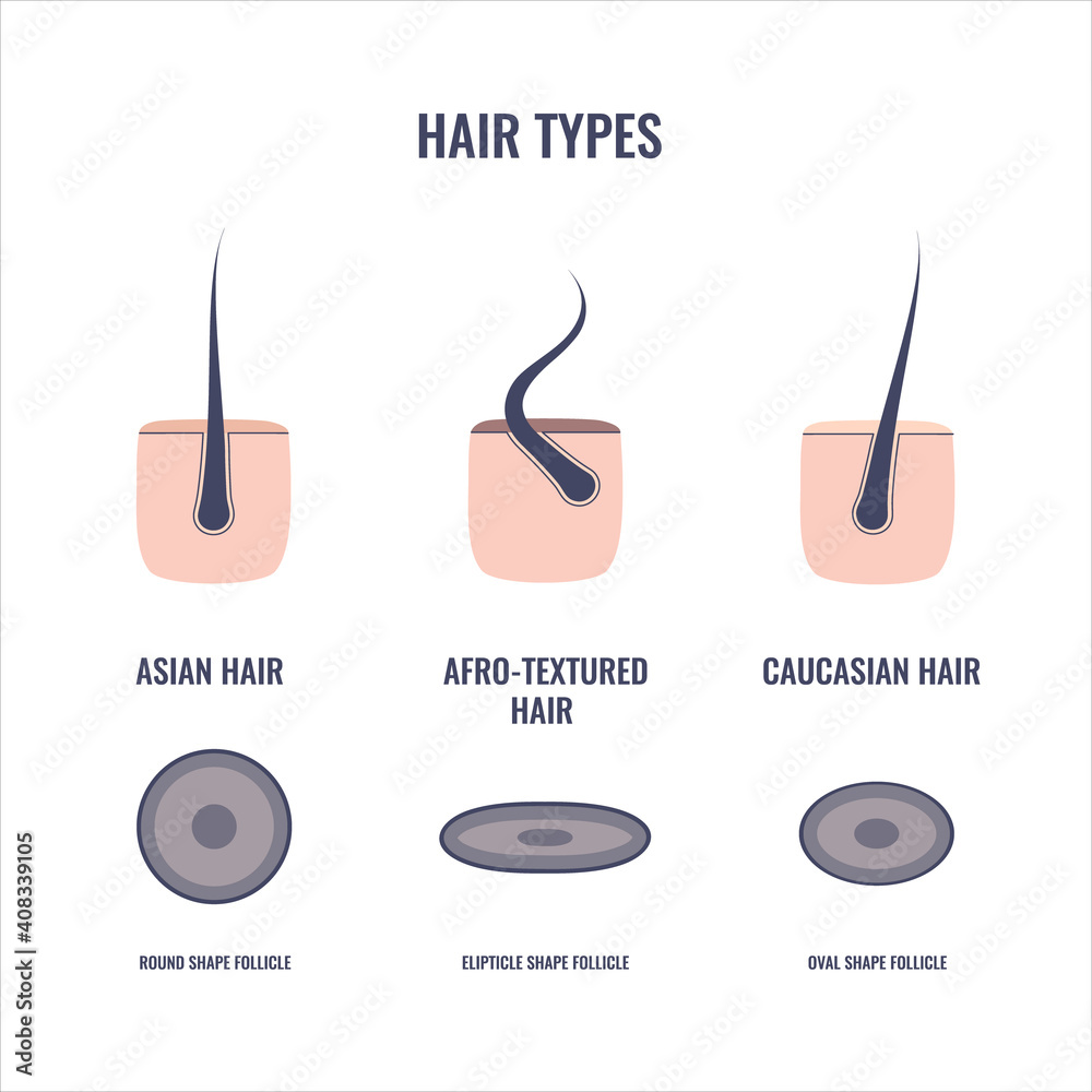 Straight, wavy and curly hair types classification set. Skin and ...