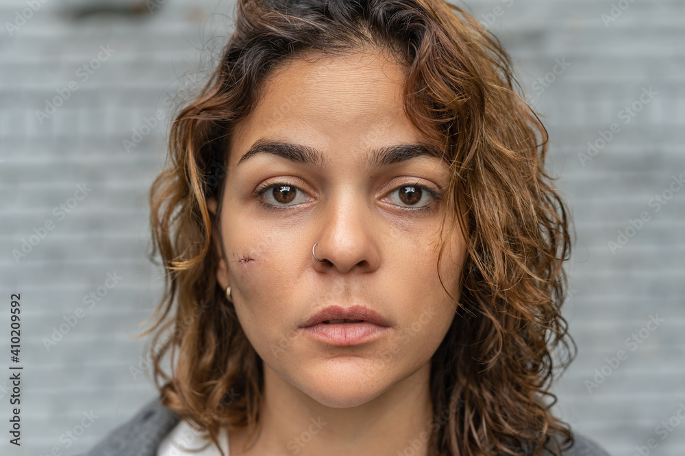 Candid portrait of a sad woman with a recent scar in her face on a grey ...