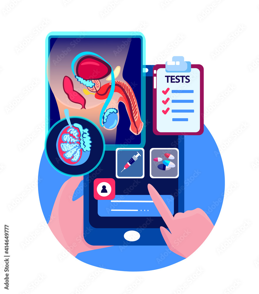 Online Touchscreen Hospital.Male Reproductive,Urogenital System Organ ...