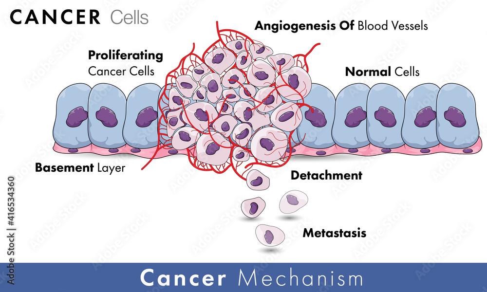 cancer cell development entire mechanism including angiogenesis ...