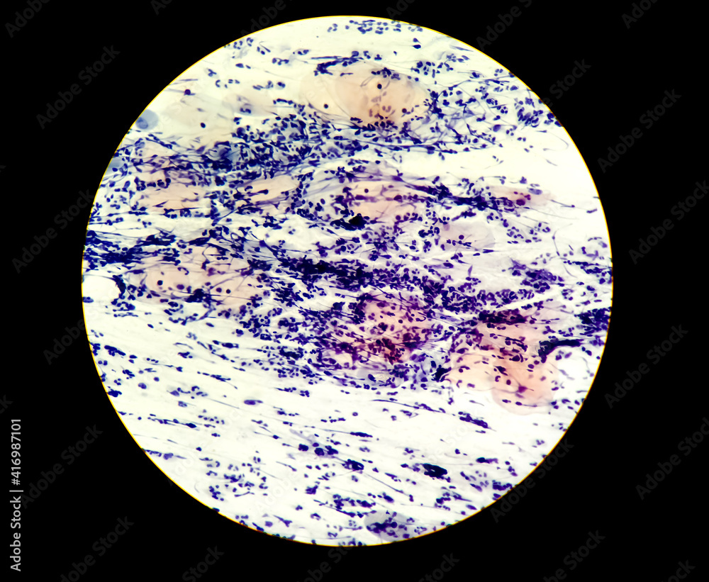 Human Cheek Epithelial Cells. The tissue that lines the inside of the ...
