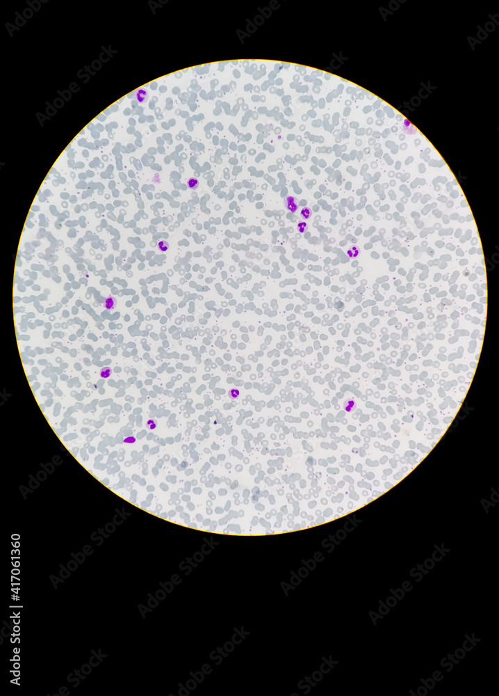 Human peripheral blood smear under 40x light microscope present ...