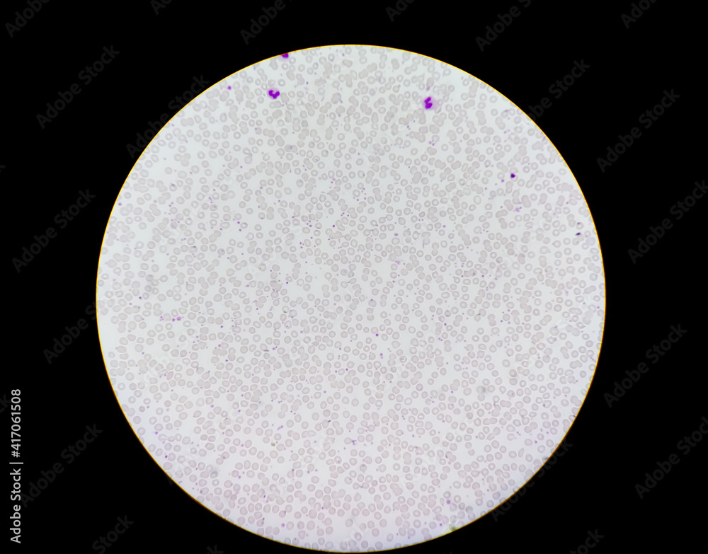 Normal endocervical cells and squamous epithelial cells of cervical ...