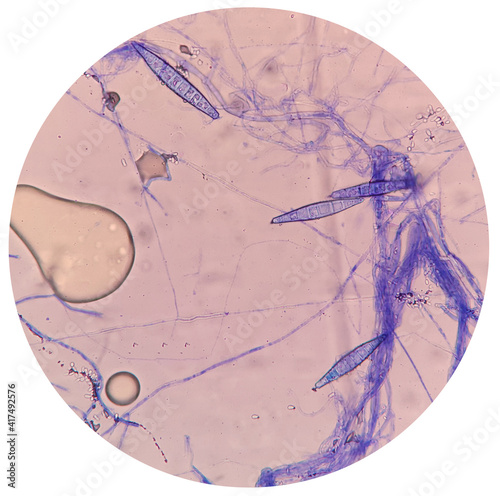 Microscopic finding shows macroconidia of Microsporum canis in dog with ...