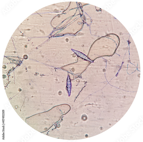 Microscopic finding shows macroconidia of Microsporum canis in dog with ...