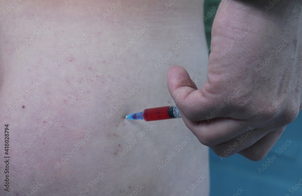 hand putting an injection with red medical fluid into the soft tissue ...