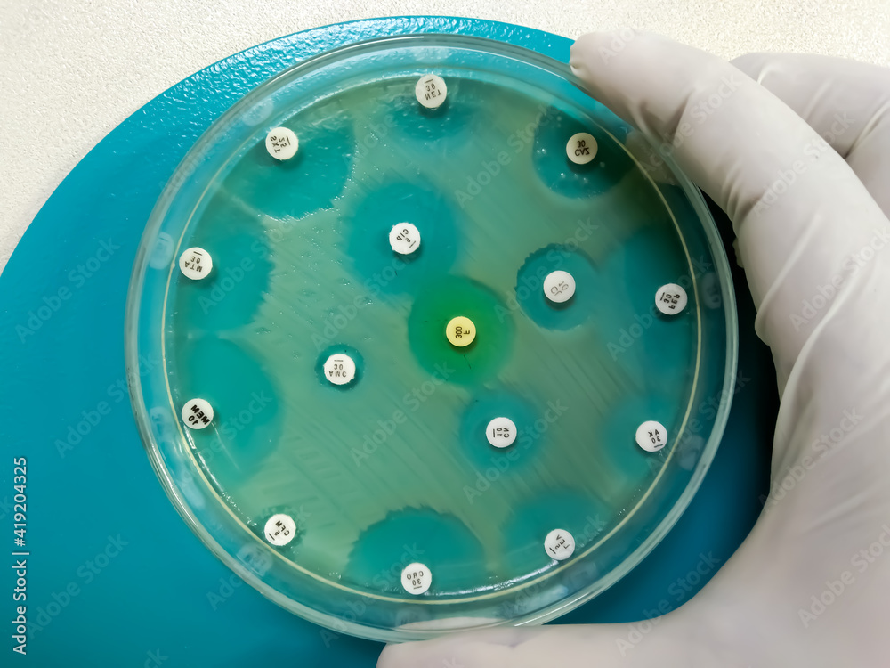 Antibiotic disk/disk drug ready for diagnosis antimicrobial ...